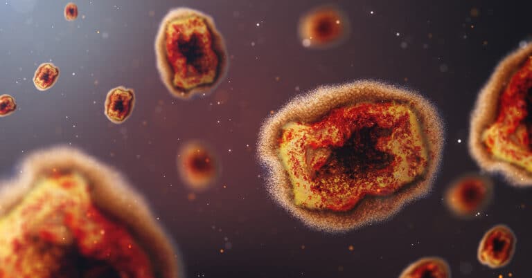 What you need to know about Monkeypox | News | DMU